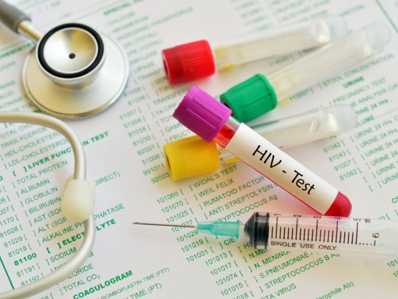What do You Need to Know About Confidential and Anonymous HIV Testing ...
